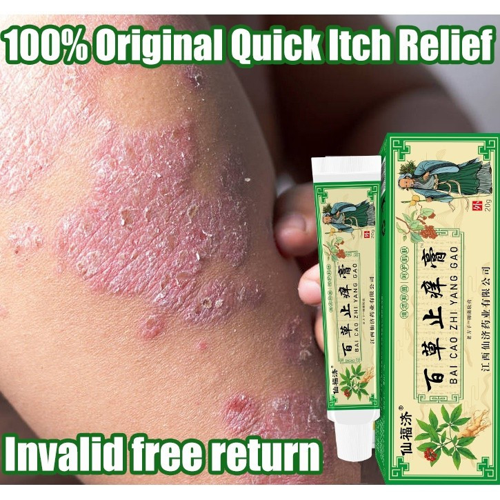cream for itchy skin eczema cream psoriasis cream Herbal antibacterial ...