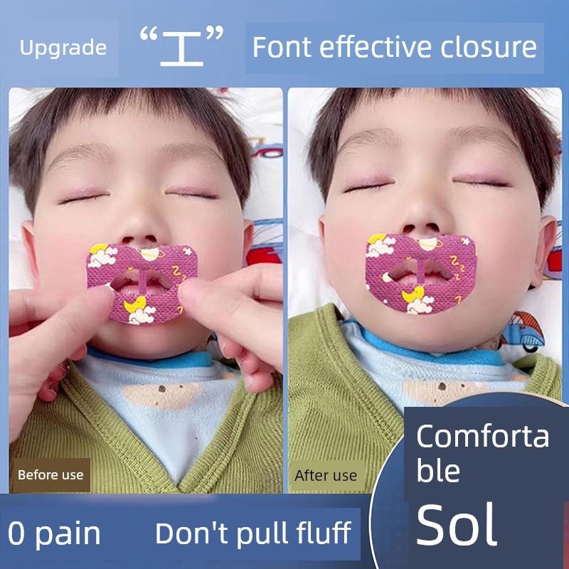 snoring stopper mouth tape German Mouth Breathing Correction Sticker ...
