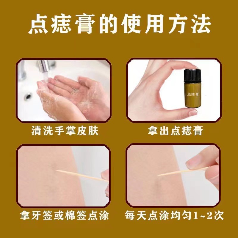 Dot Mole Cream Traceless Remove Mole Black Mole Fiber Warts Liquid ...