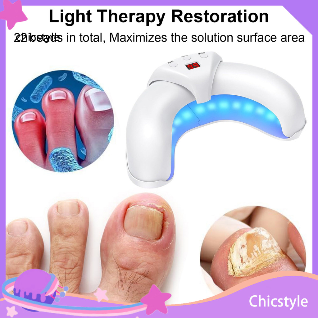 chicstyle Toenail Fungal Light Nail Fungus Therapy Light 22 Led Nail ...
