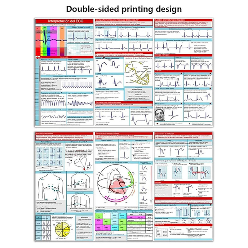[linshgjkuS] EKG Pocket Guide, EKG Rhythm Interpretation, Double ...