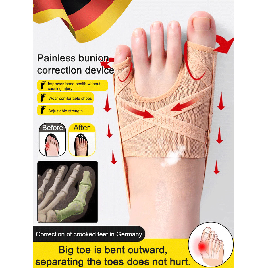 1/2/3/4 Pairs 🌺German Quality🌺Mesh Hallux Valgus Big Toe Orthosis ...
