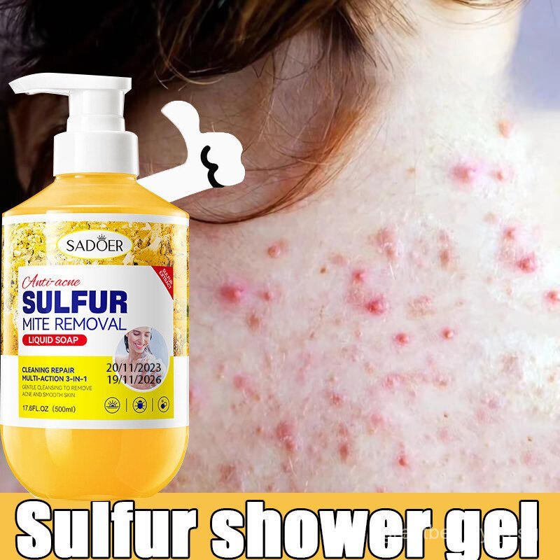 100% original sulfur mite removal shower gel antibacterial shower gel ...