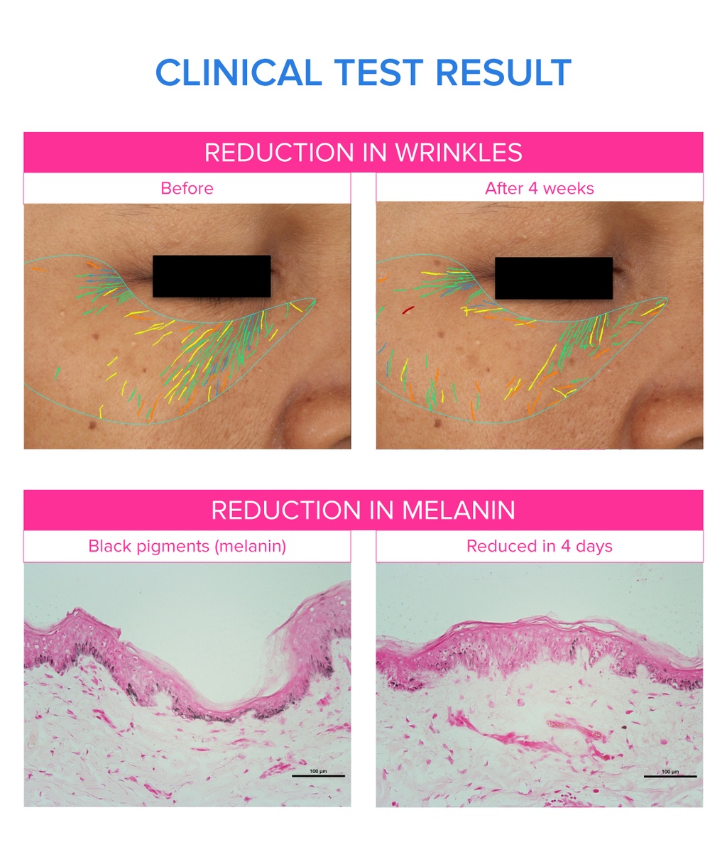 [FEBRUARY EXCLUSIVE] DERMA LAB Lumiclar Pure Vitamin C15 Serum 15ml x 2 ...