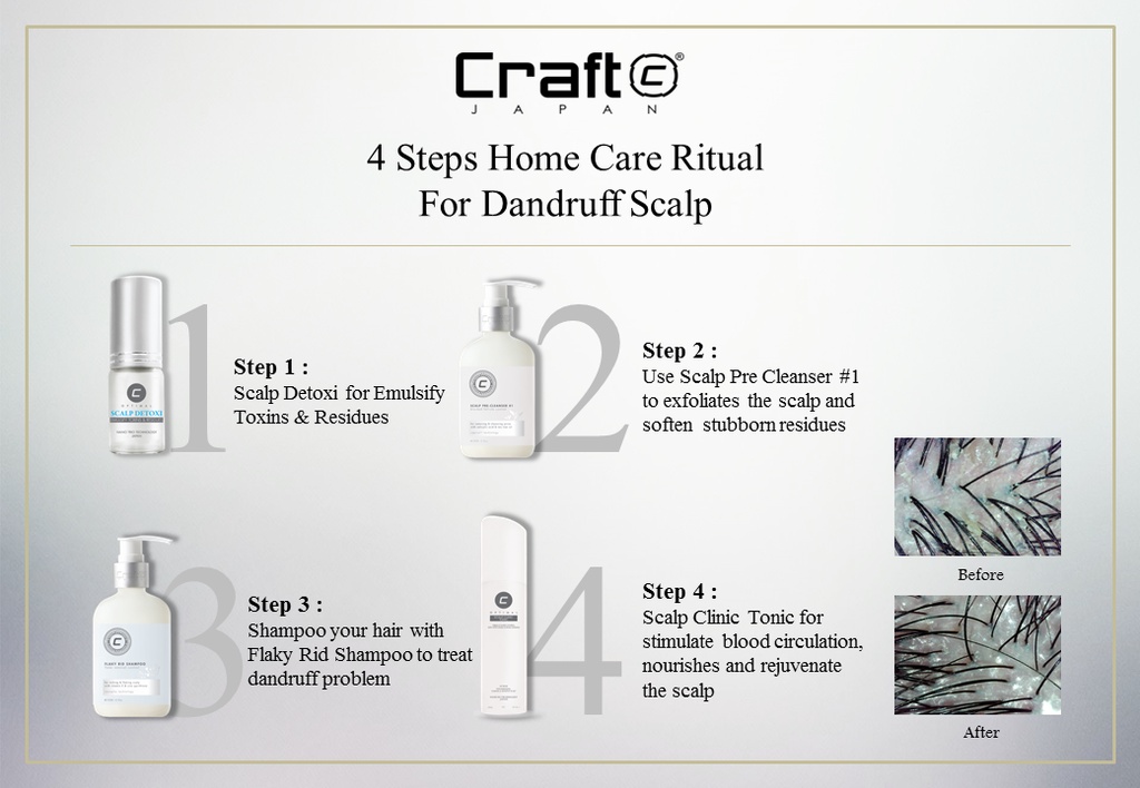 Craft Scalp Clinic Shampoo 50ml 300ml 1000ml ( For Energizing ...