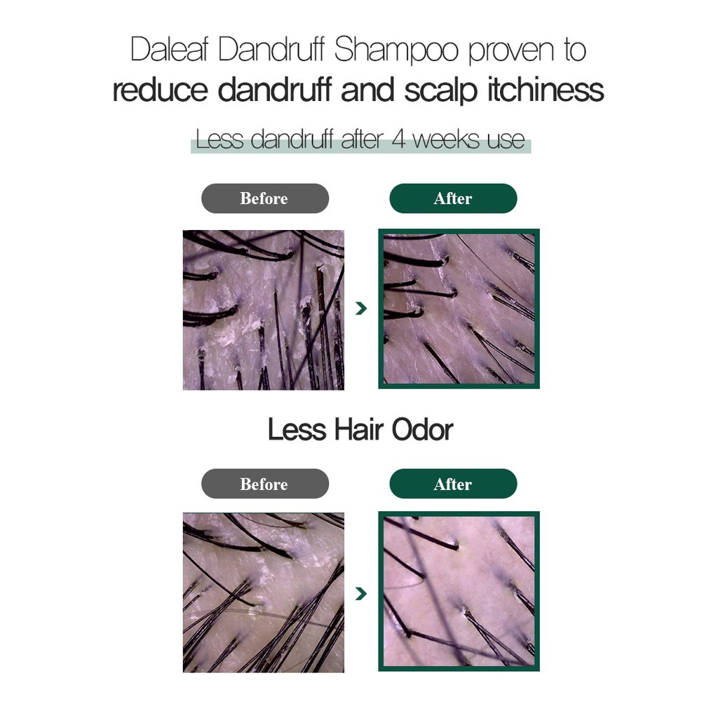 [DALEAF] Better Root Dandruff Shampoo 500ml (Anti-Hair Loss Shampoo ...