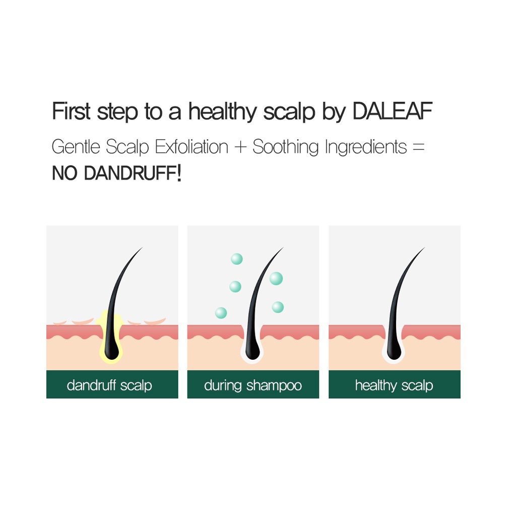 [DALEAF] Better Root Dandruff Shampoo 500ml (Anti-Hair Loss Shampoo ...