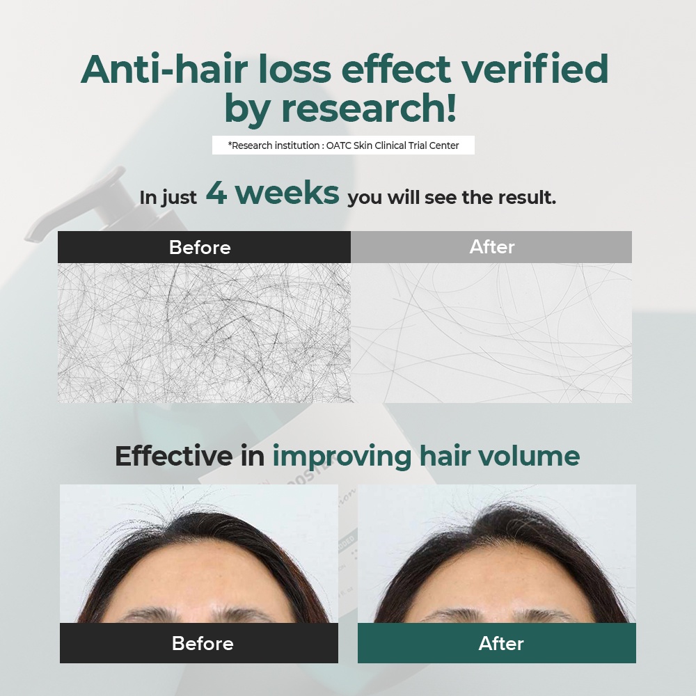 [GRAFEN] Root Booster Shampoo 500ml + Root Booster Tonic 160ml + Cica ...