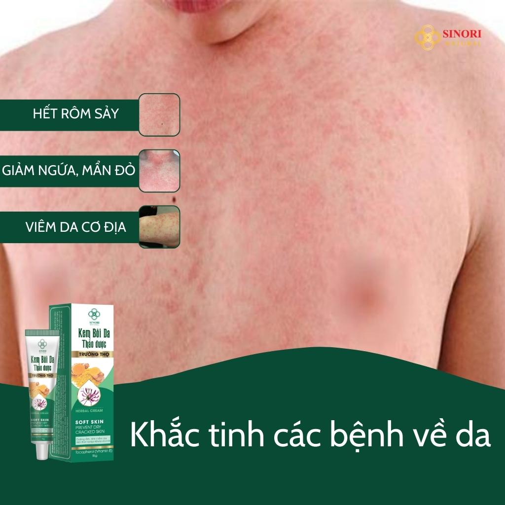 Sinori Longevity Herbal Skin Cream 15g | Shopee Singapore