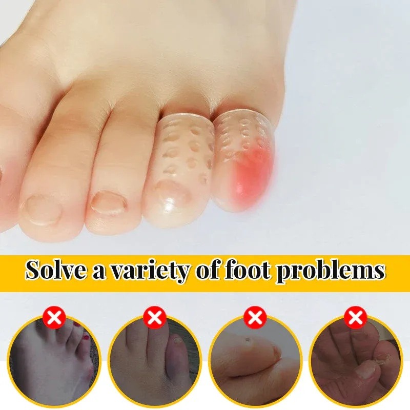 Prevents Foot Corns Blisters Foot Care Tool Breathable Anti-Friction ...