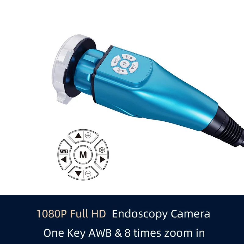 Surgical Portable Medical Endoscopy ENT Camera Endoscope Camera ...