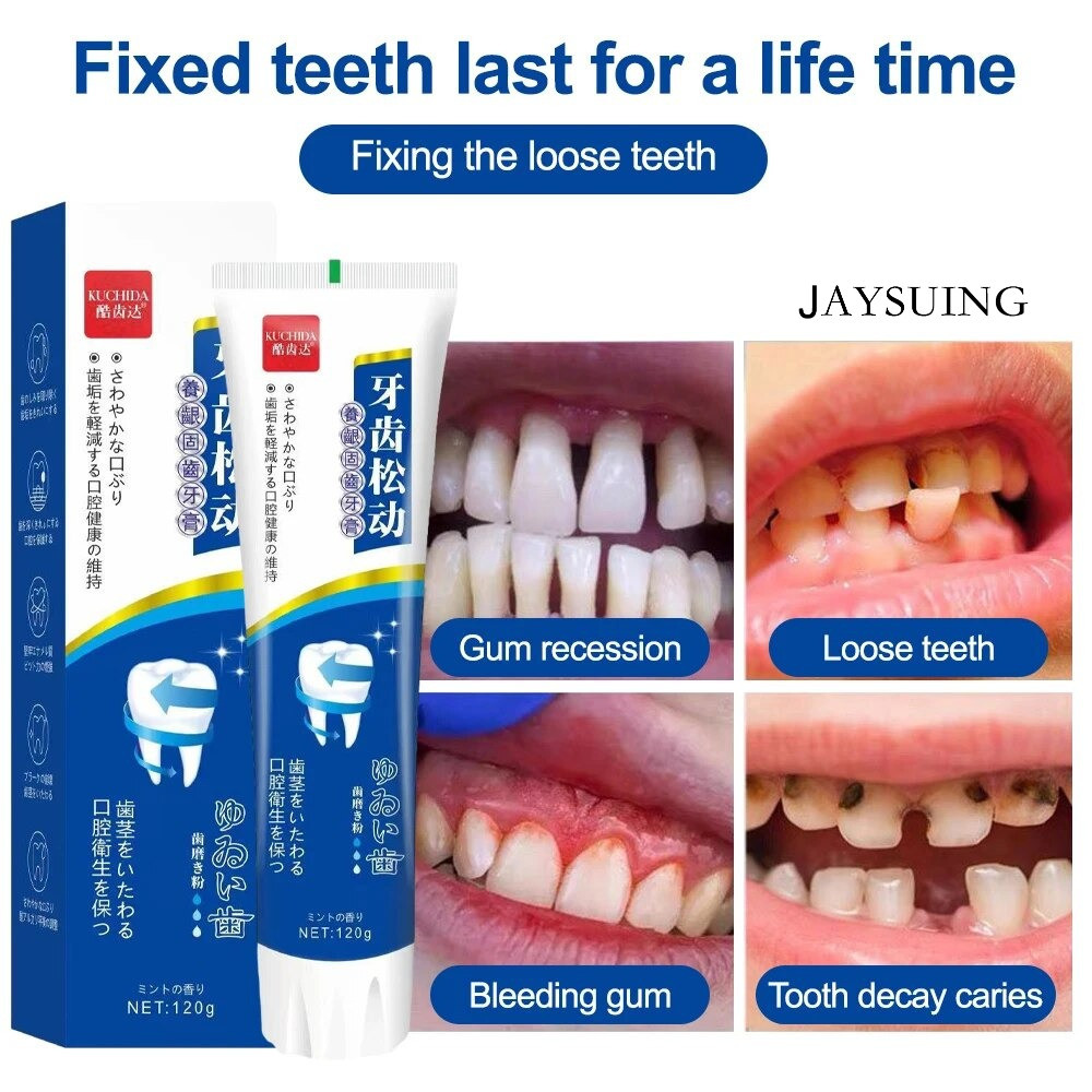 【Original Quality】Jaysuing Tooth Repair Loose Teeth Care Toothpaste ...