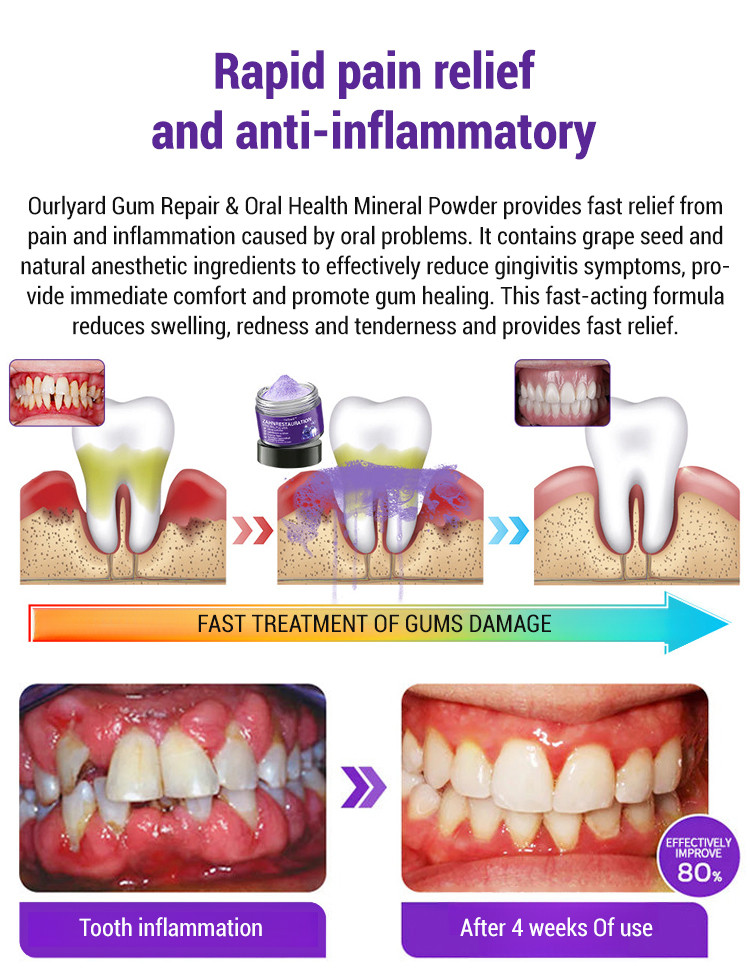 🔥Original Imported🔥【Periodontal Repair/Fresh Breath】Tooth Repair Purple ...