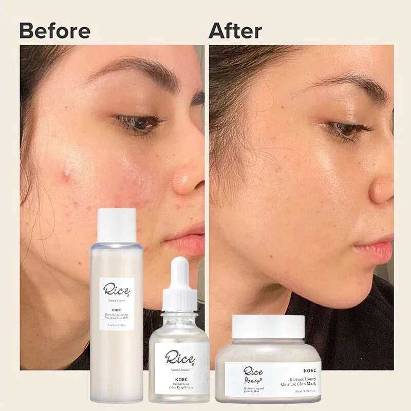 Rice Extract Deep Moisturizing Koec Rice Honey Facial Care Set Face ...
