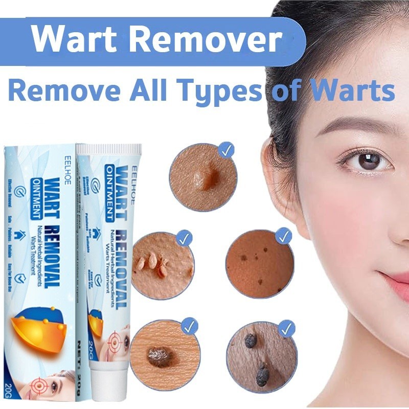 Warts Remover Original Cream 20g Natural Herbal Ingredients Warts ...