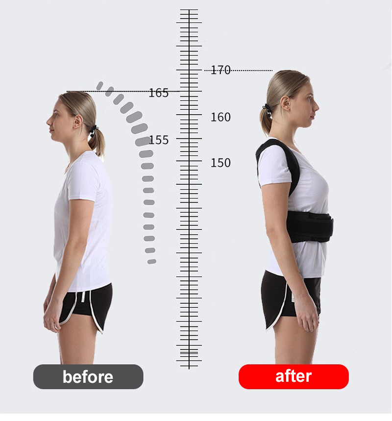 Newest 3XL 4XL Medical Slouching Corrective Orthopedic Scoliosis Spine ...