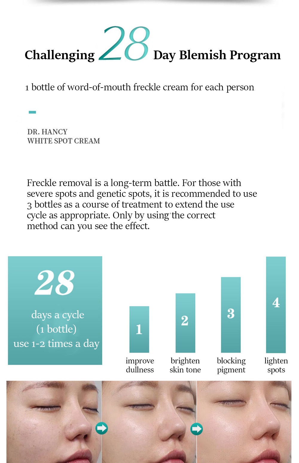 Japanese Melasma Cream Yunnan Herbal Whitening Freckle Cream Japanese ...