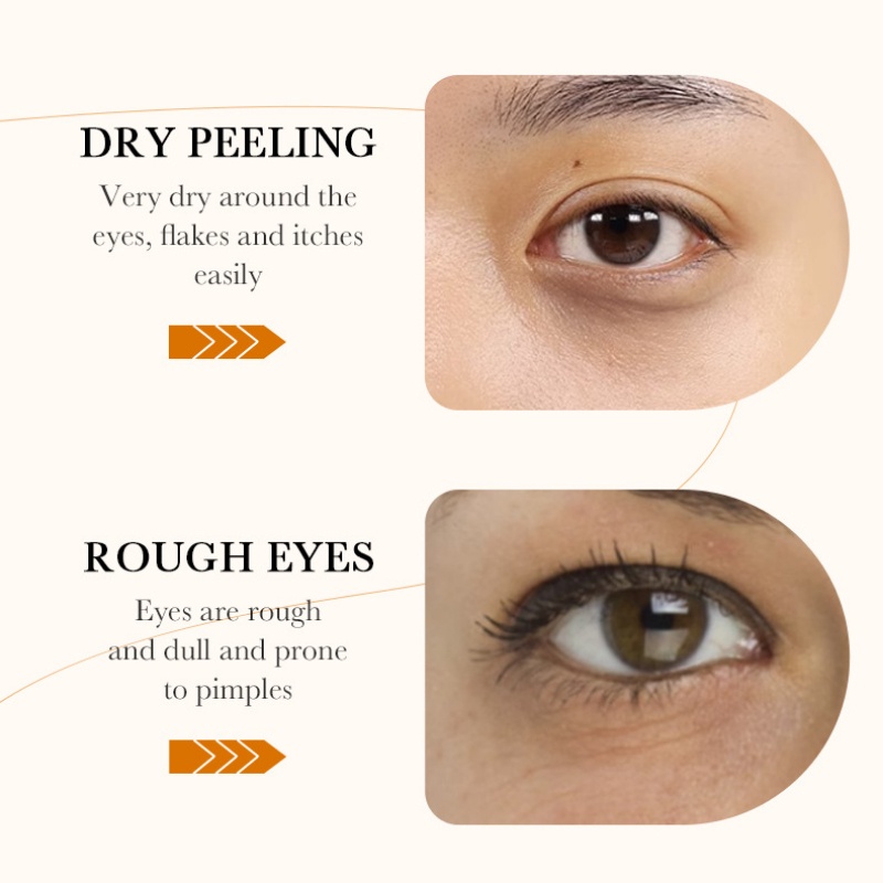 BIOAQUA Rice Raw Pulp Eye Mask Moisturizing Reduce Dark Circles and Eye ...