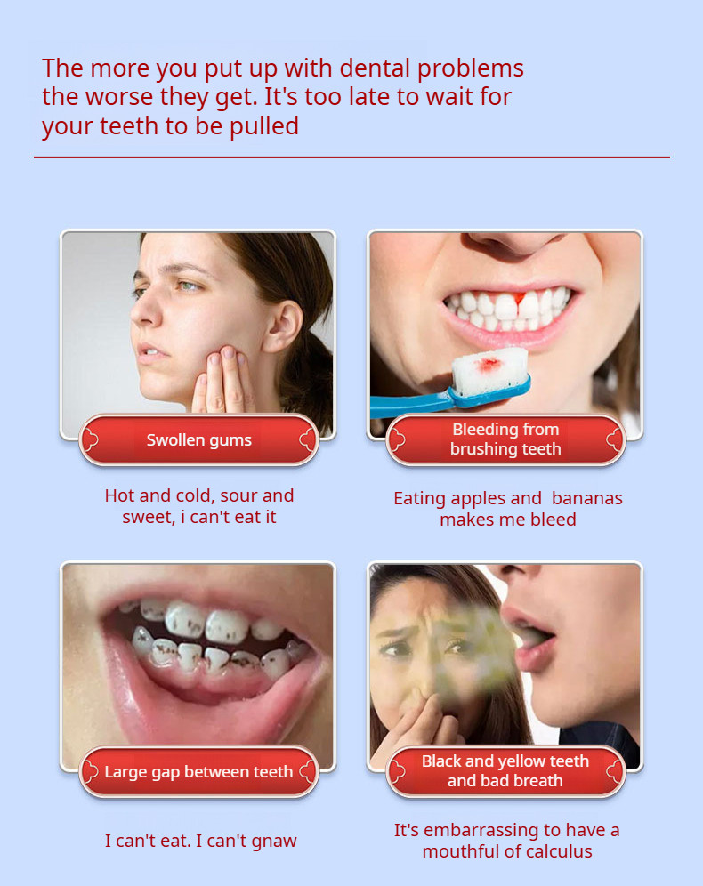 [Precise Application/Non-Invasive] Dental Teeth Separating Agent ...