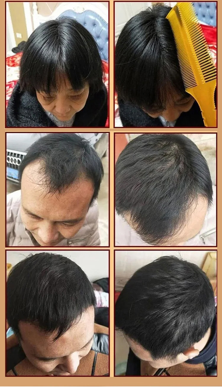 Sandalwood Comb Scrape Without Damaging the Skin Unblock the Meridians ...