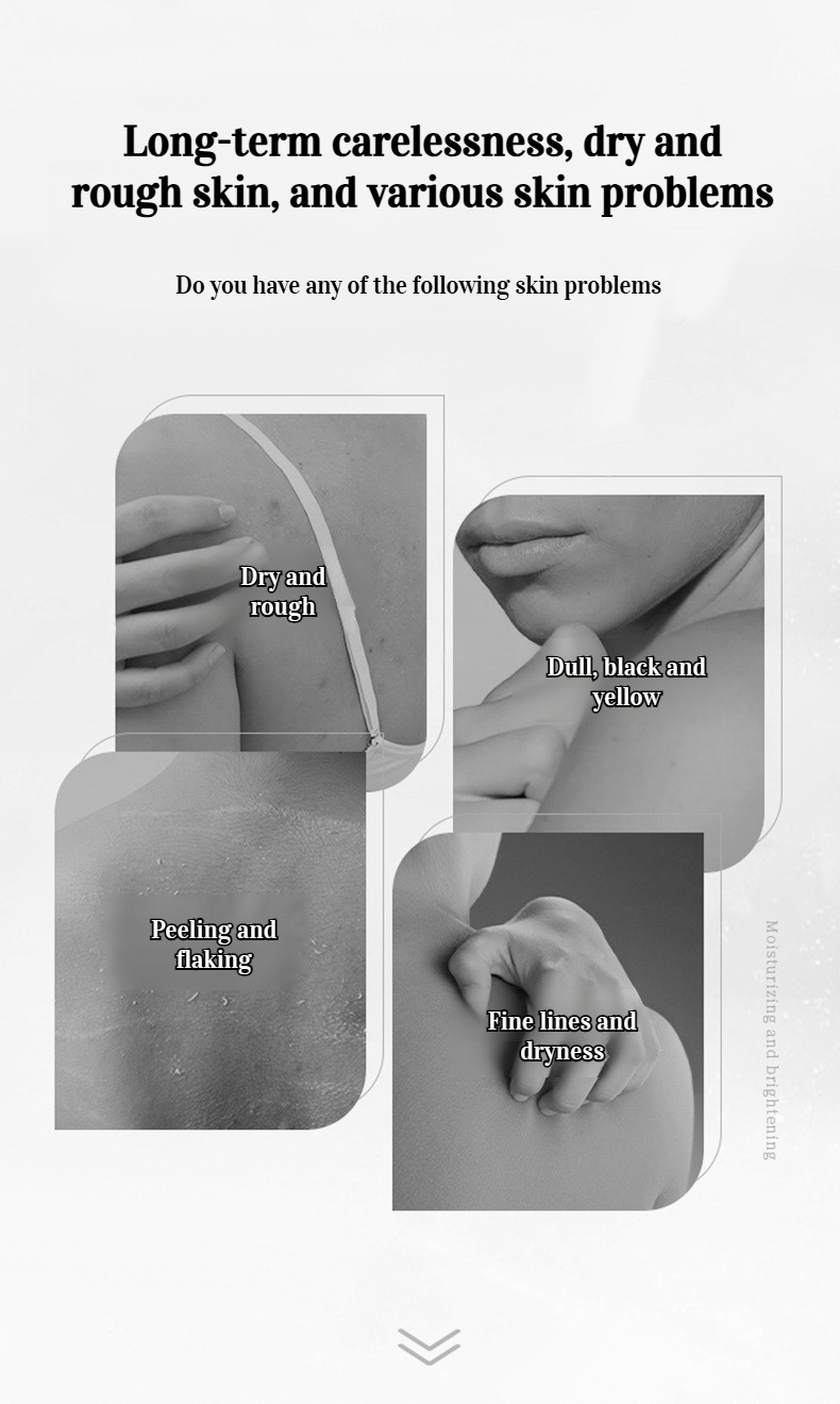 7 Days【Old Spots and Yellow Spots Disappear】Spot Fading Urea Cream Triple Whitening/Freckle ...