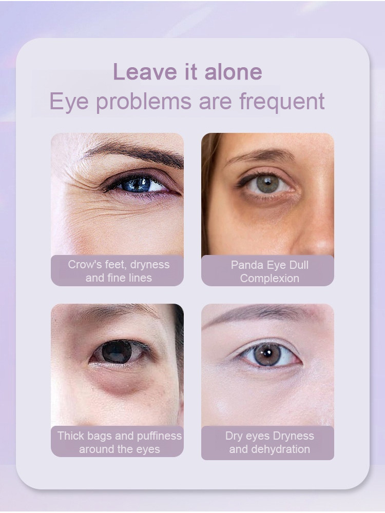 【⚡Ready Stock⚡】[ Lighten Dark Circles/Hydrating Moisturizing/Lifting ...