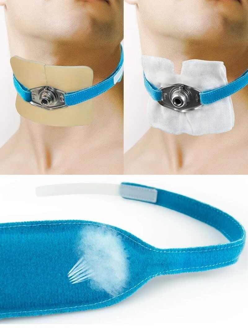 Tracheal belt ventilator with tracheal fixation belt and tracheotomy ...