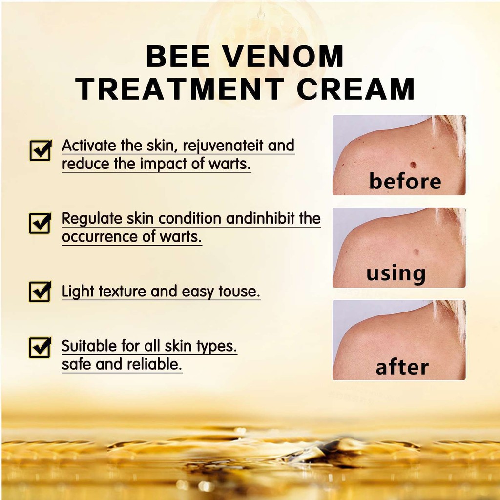 【Buy1 Take 1】Bee Venom Cream, 30g Professional Bee Venom Cream, Bee ...