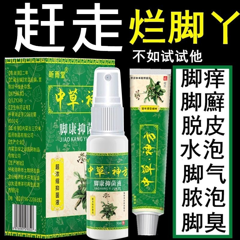 Chinese Herbal Formula Athlete's Foot King's Athlete's Foot Spray Itchy ...