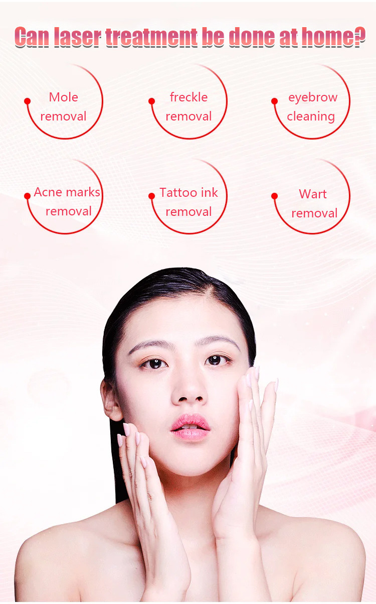【HOT】[Easy Restore Smooth Skin] Charged Beauty Pen Tattoo/Moles/Acne Scars/Warts Removal/Safe ...