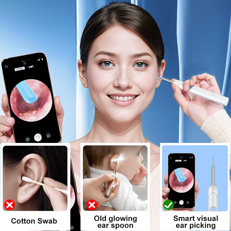 SG Earpick Smart Visual Ear Picker 15-in-1 With Camera For Baby Adult ...