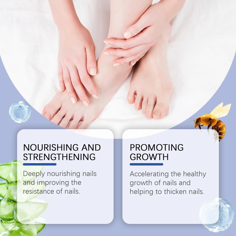 Nail Ingrown Cure Paronychia Removal Repair Onychomycosis Toenail ...