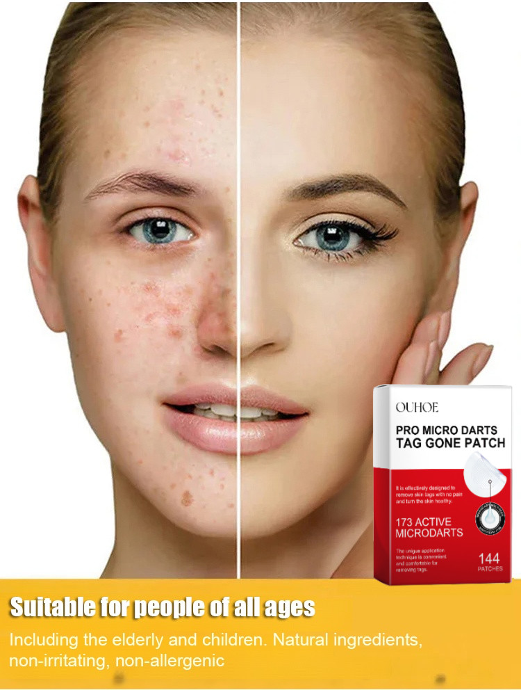 🔥Wart Removal🔥Quick Wart Removal Patch/Plant-Based Wart Removal/Plant ...