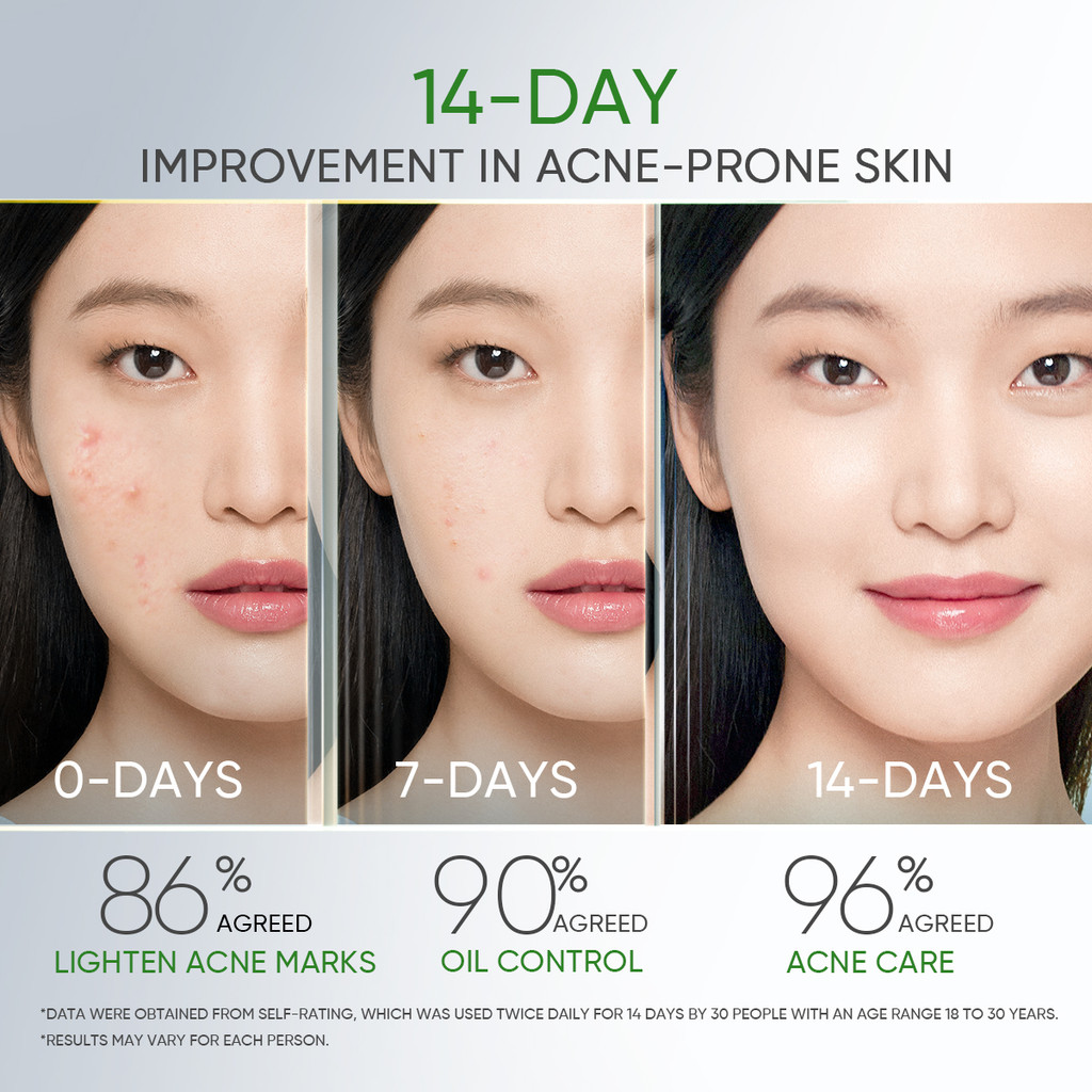 SKINTIFIC 3X Acid Anti-Acne GEL Moisturiser Cream 30g--Calms & Soothes ...