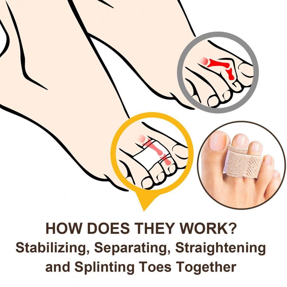 1Pcs Toe Finger Straightener Hammer Tape Hallux Valgus Corrector ...