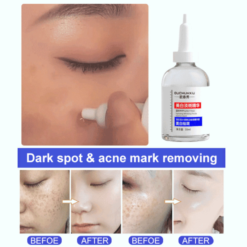 【Ready Stock】[Removing Spot/Brightening/Hydrating] Hyperpigmentation ...