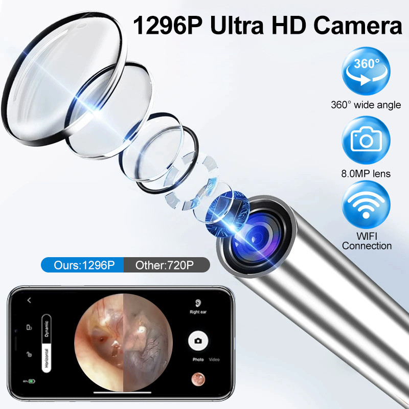 SG Earpick Smart Visual Ear Picker 15-in-1 With Camera For Baby Adult ...