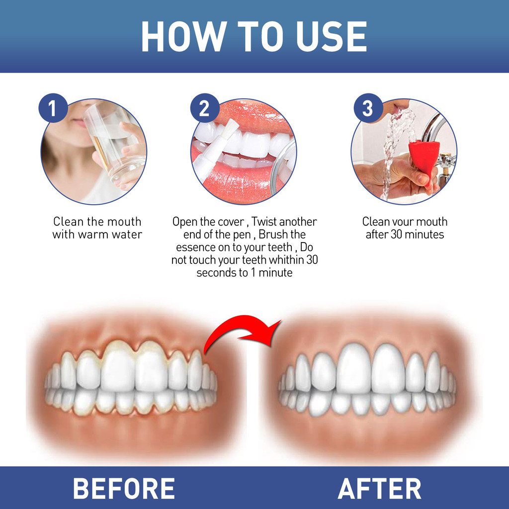 1pcs Gum Instant Soothing Gel Receding Gums Inflammation Relieve ...