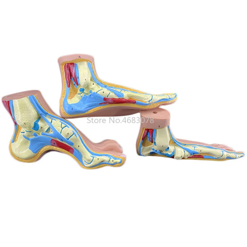 3Pcs/Set Normal Foot/Flatfoot/ArchedFoot Anatomical Model Of Skeletal ...