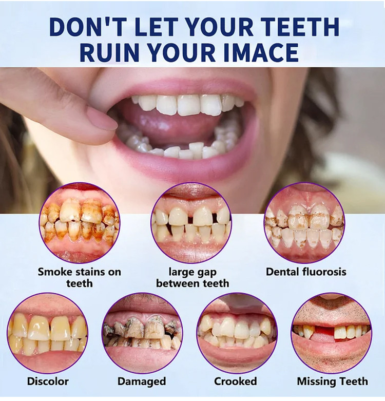 Realistic simulated braces Dental Supplies Soft fit Does not hurt the ...