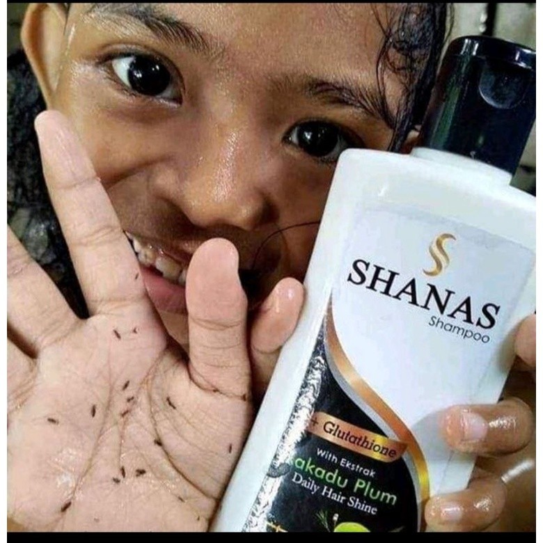 in stock Advertisement Shampoo For Lice Removal, anti, anti Loss And ...