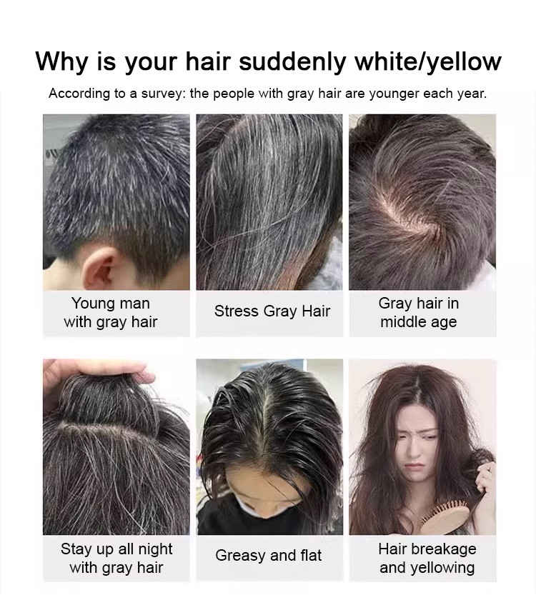 SG HOT [Grey Hair No Longer Grows] Saffron Essence Spray from White to ...