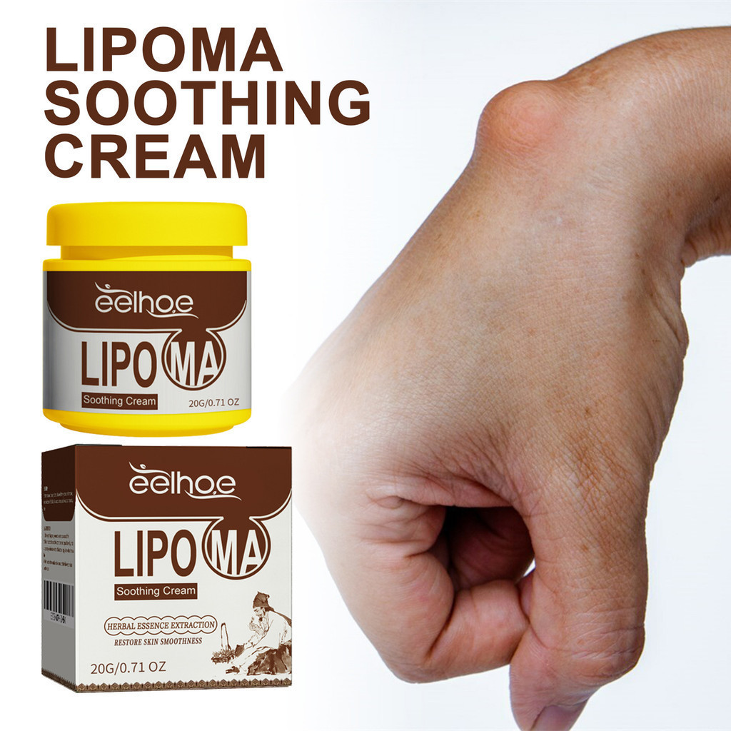 Soothing Cream Subcutaneous Lumps Remover,Fat Lump Skin Hard Mass ...