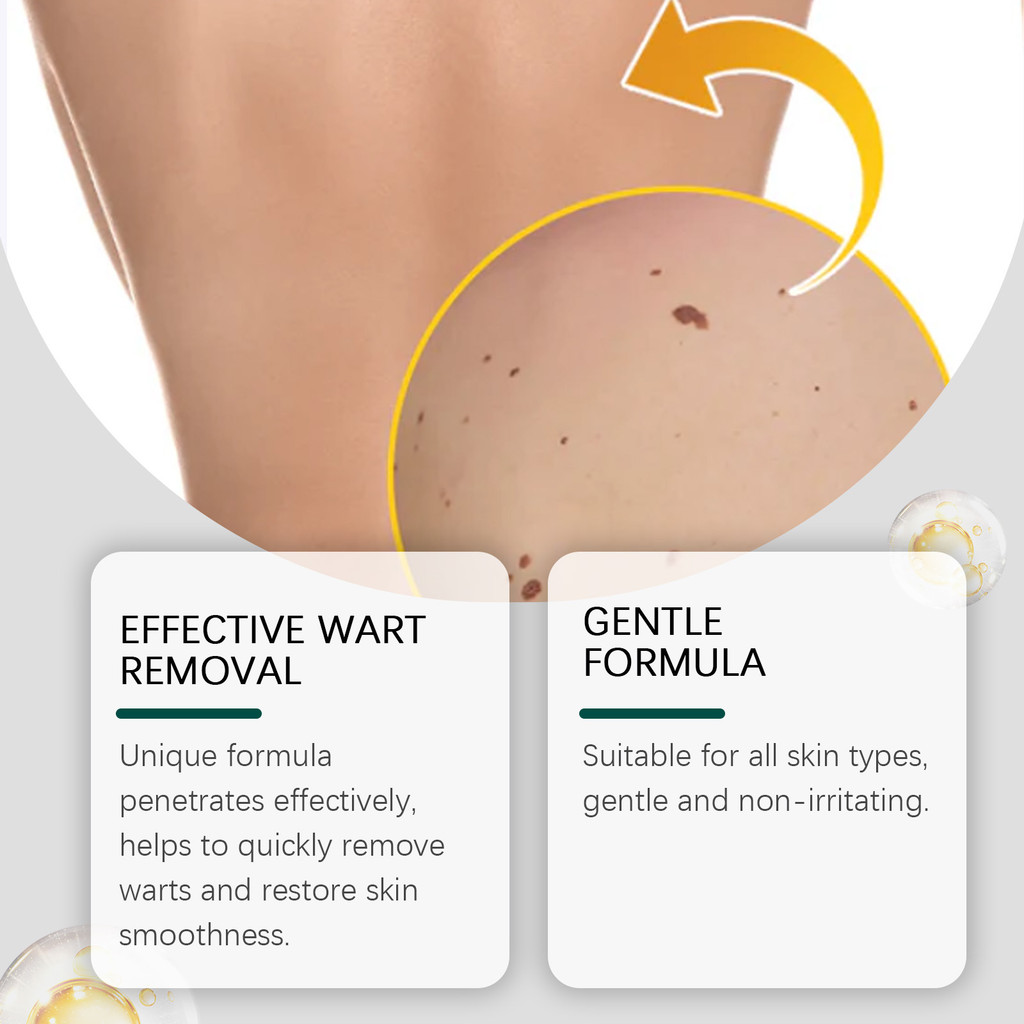 OUHOE Body Skin Care Microneedle Patch Smooth Skin Gentle Cleansing ...