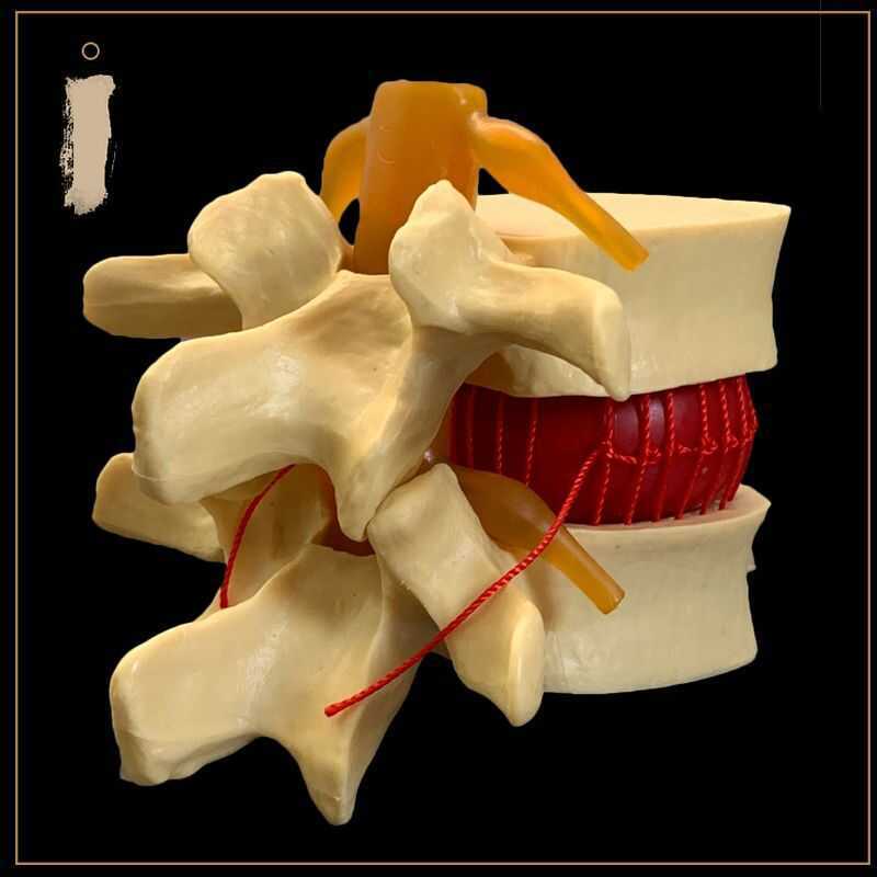 Free Shipping!Human Body Lumbar Spine Disc Demonstration Model Lumbar ...