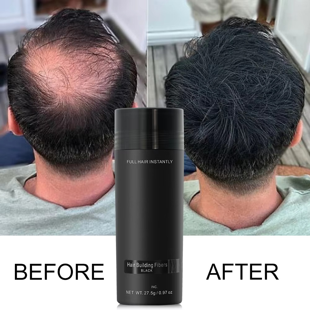 (🔥SG stock🔥 ) 5Pcs Toppik Natural Hair Boosting Fiber Powder Thickening ...