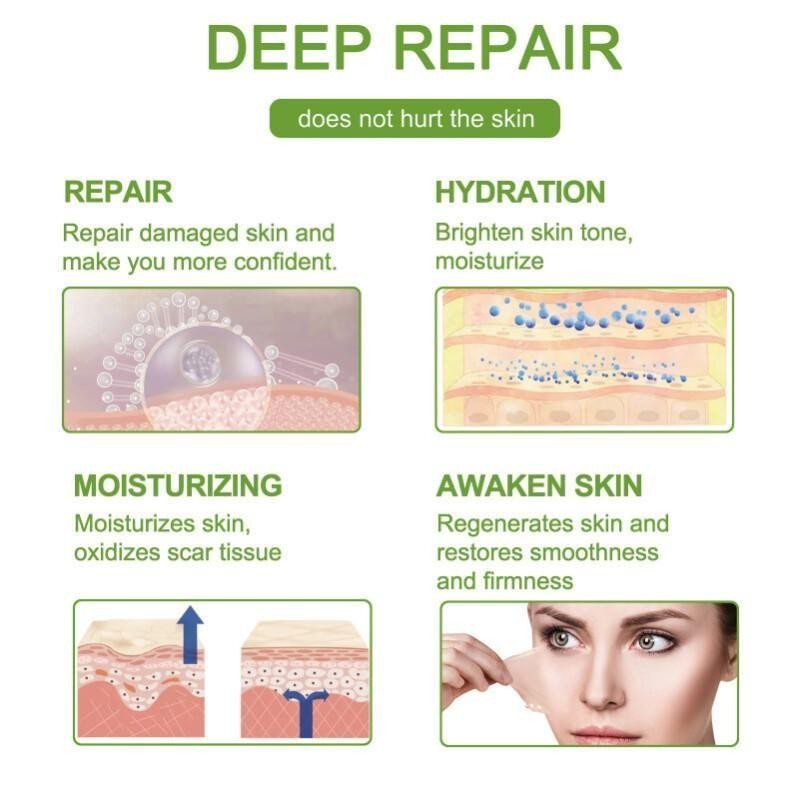 1 Roll/Box Scar Patch Skin Color Remove Scars From Reveal Smooth And ...