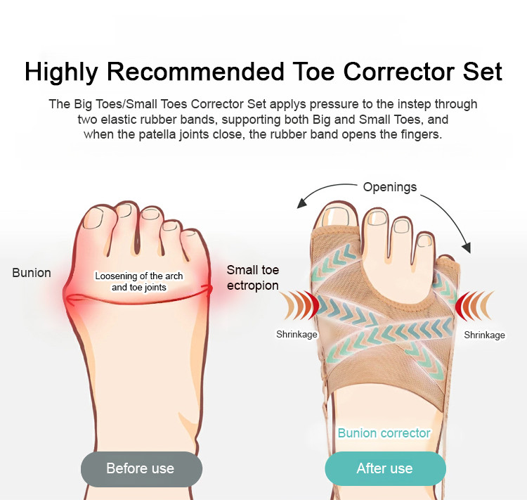 1/2/3/4 Pairs 🌺German Quality🌺Mesh Hallux Valgus Big Toe Orthosis ...