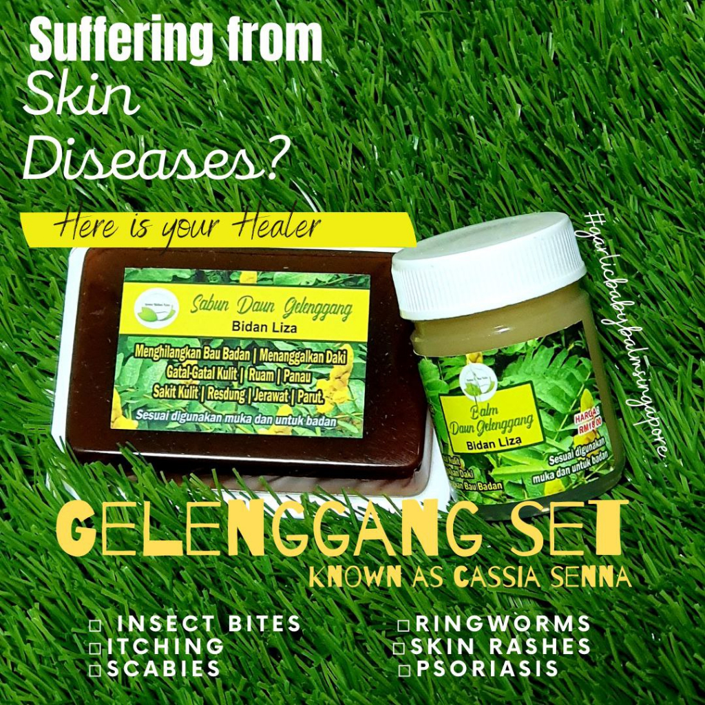 CASSIA SENNA (GELENGGANG) BALM / SOAP / LOTION BY BIDAN LIZA for ...