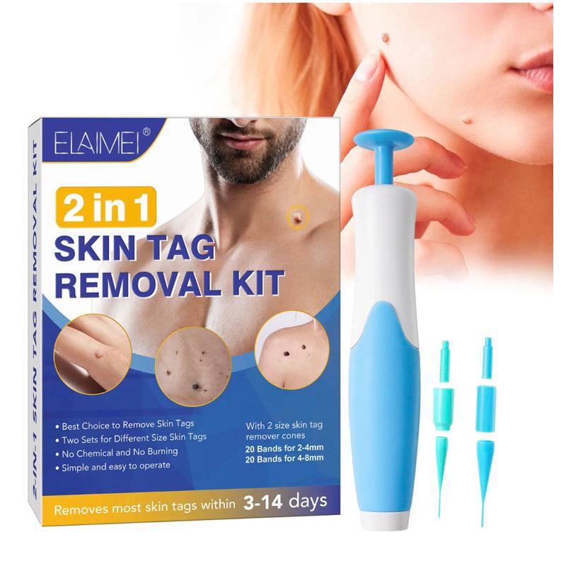 Home Use 2-in-1 Skin Tag and Spot Removal Pen Kit, Painless, Safe and ...